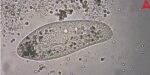 Paramecium Diagram, kingdom, Classification, Structure